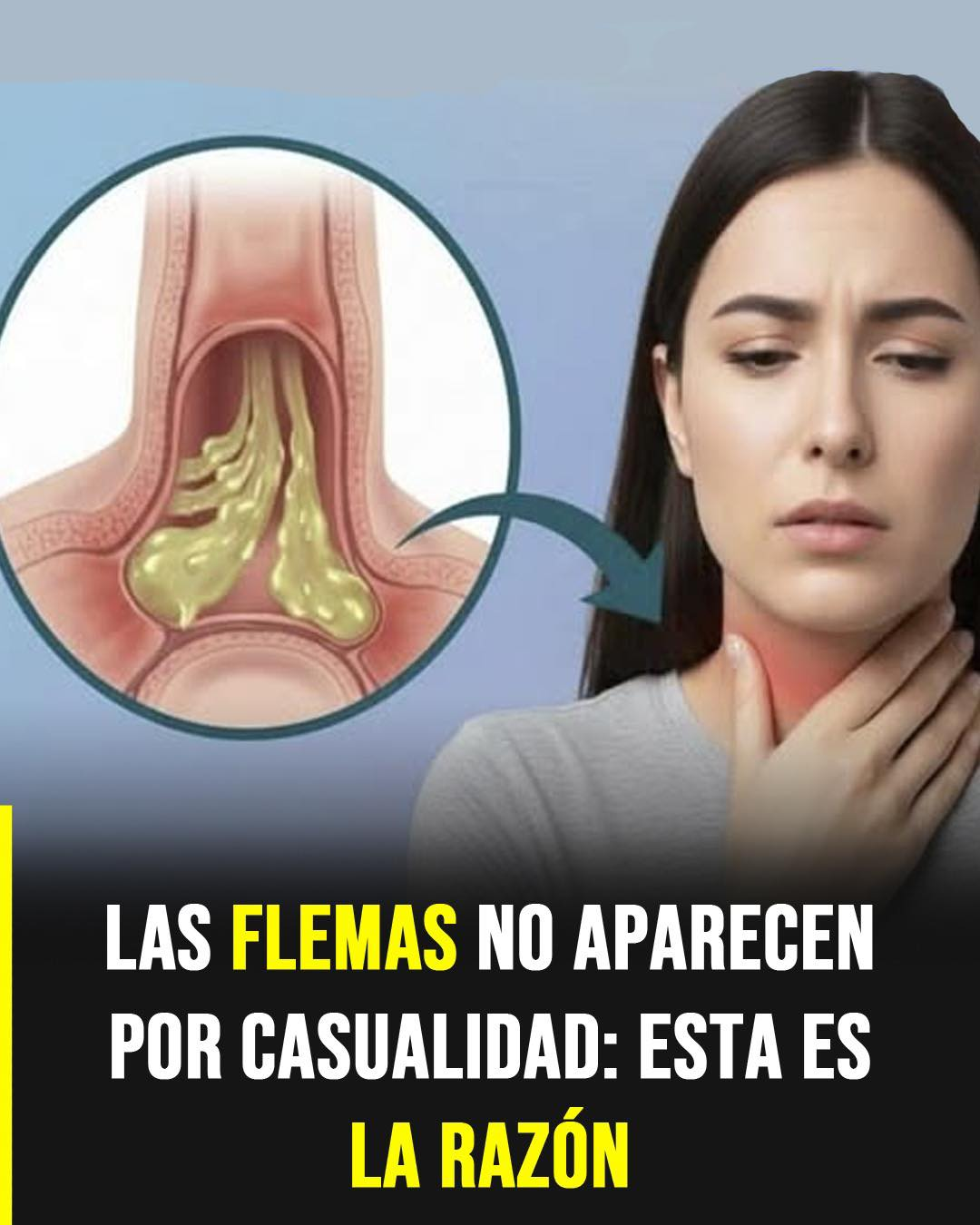¿Flemas constantes en la garganta y no sabes por qué... Ver más - Amazing
